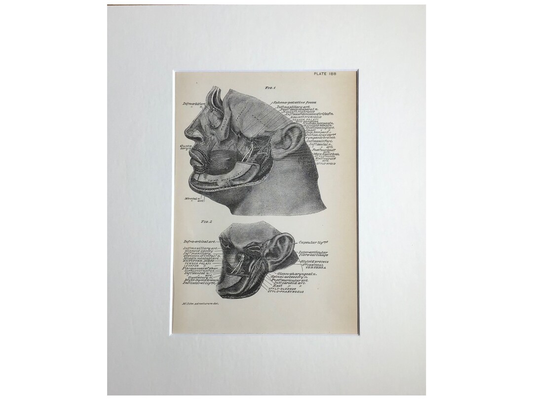 Anatomy Print, 1888 NYC, Autopsy Print, Antique Print, Dissection Print ...