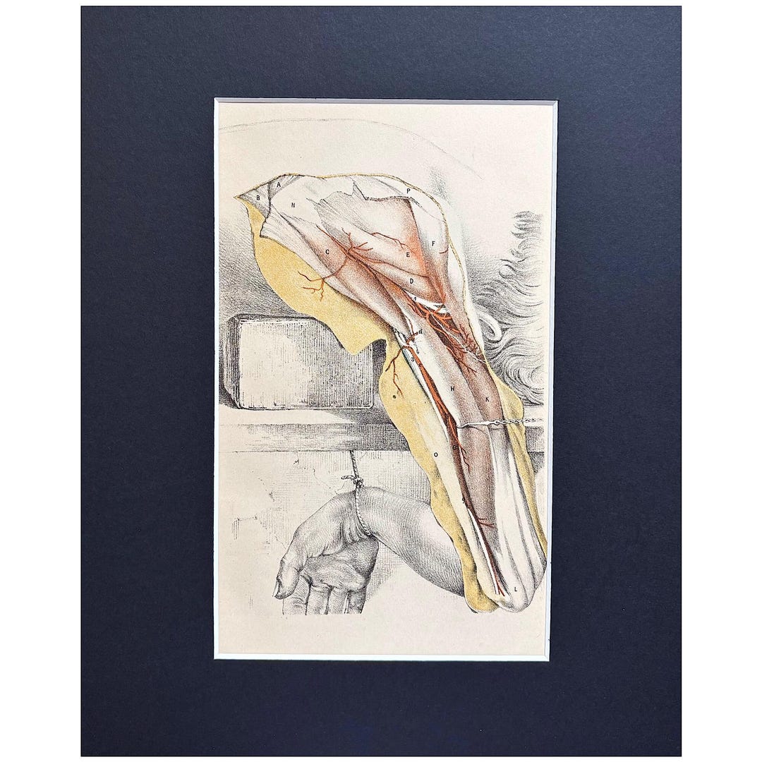 Antique Anatomy Print, Arm Section, Printed in 1882 , NYC , Dissection ...