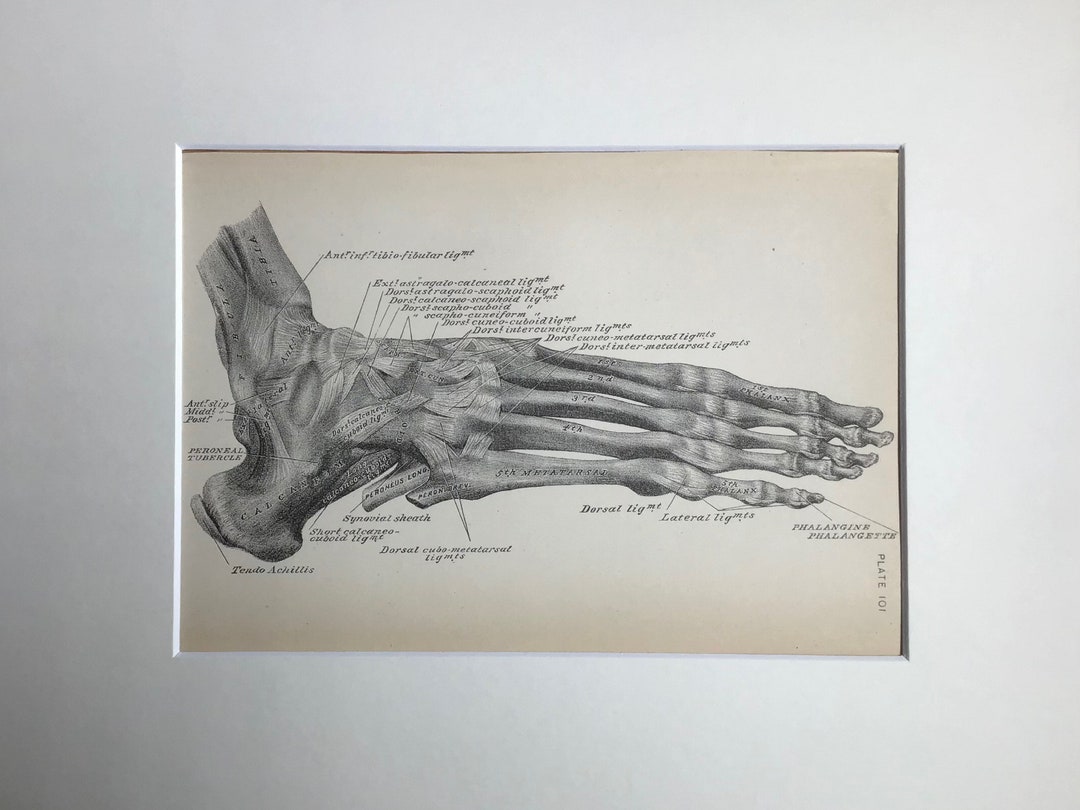 Anatomy Print, 1888 NYC, Autopsy Print, Antique Print, Dissection Print ...