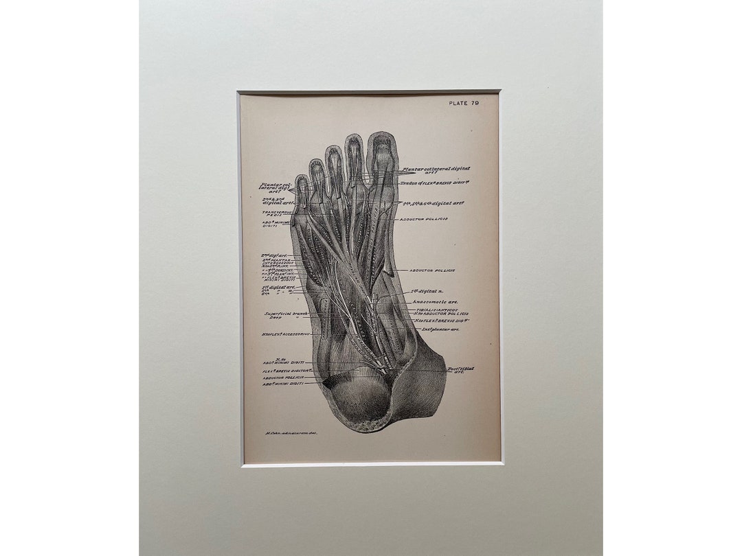 Anatomy Print, 1888 NYC, Autopsy Print, Antique Print, Dissection Print ...