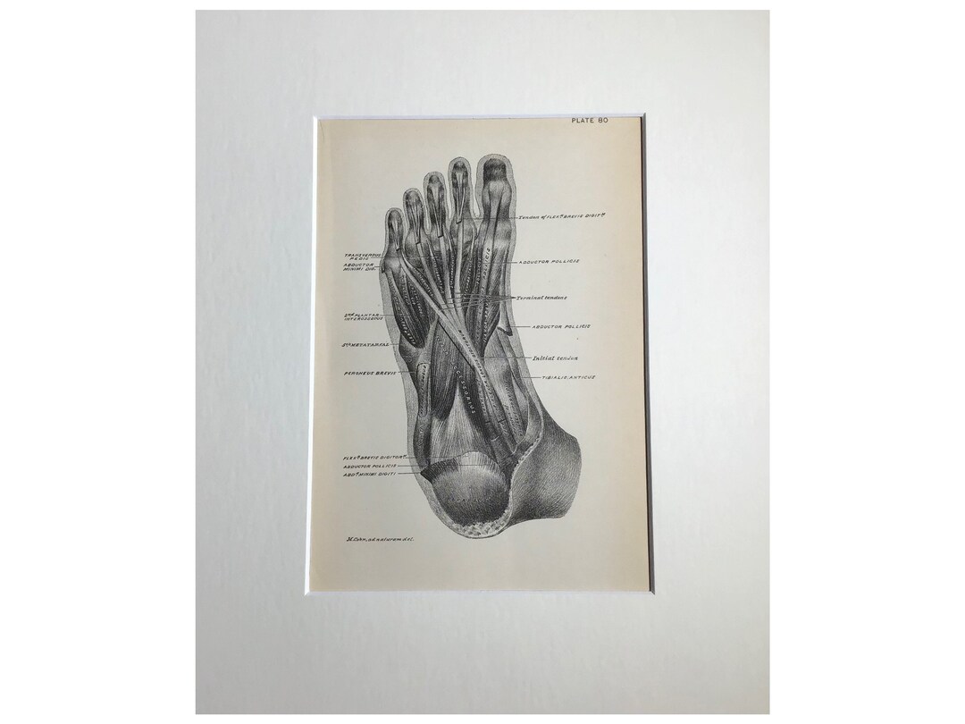 Anatomy Print, 1888 NYC, Autopsy Print, Antique Print, Dissection Print ...