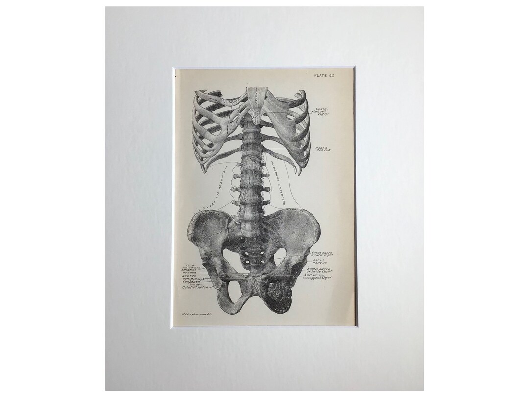Anatomy Print, 1888 NYC, Autopsy Print, Antique Print, Dissection Print ...