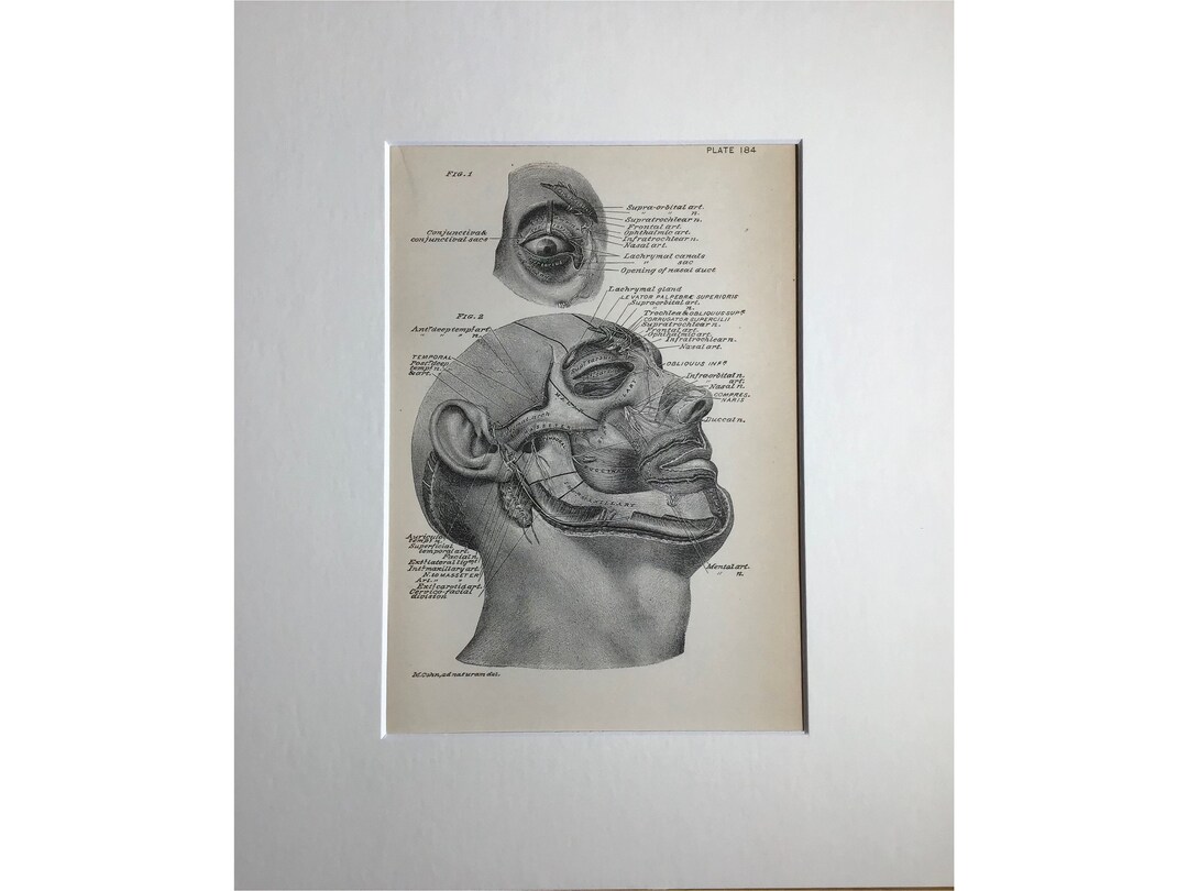 Anatomy Print, 1888 NYC, Autopsy Print, Antique Print, Dissection Print ...
