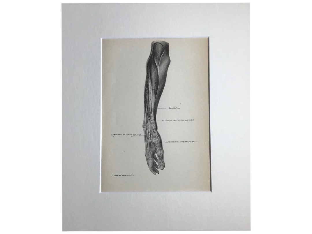 Anatomy Print, 1888 NYC, Autopsy Print, Antique Print, Dissection Print ...