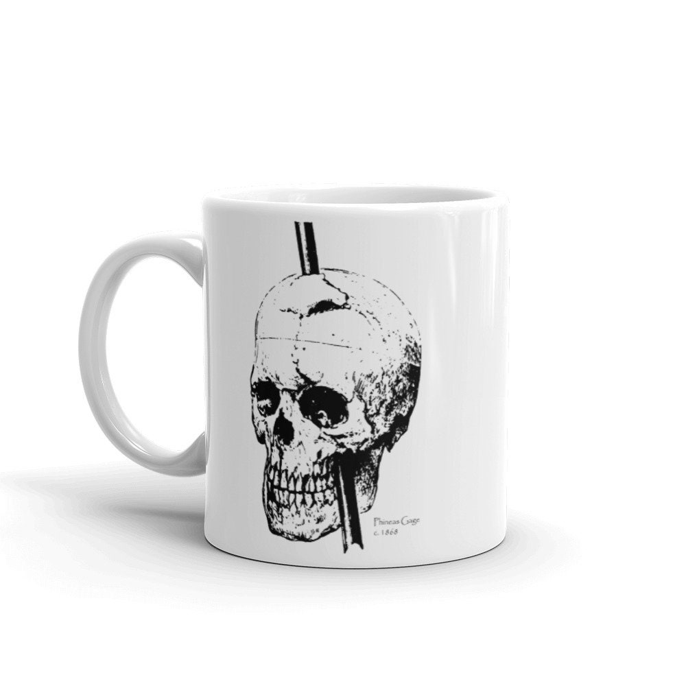 Phineas Gage Mug (with Photo) - Etsy