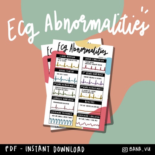 ECG Abnormalities Poster PDF - Etsy