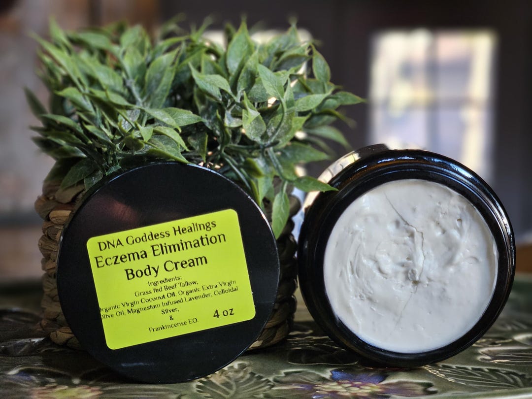 4 Oz Eczema Elimination Body Cream - Etsy
