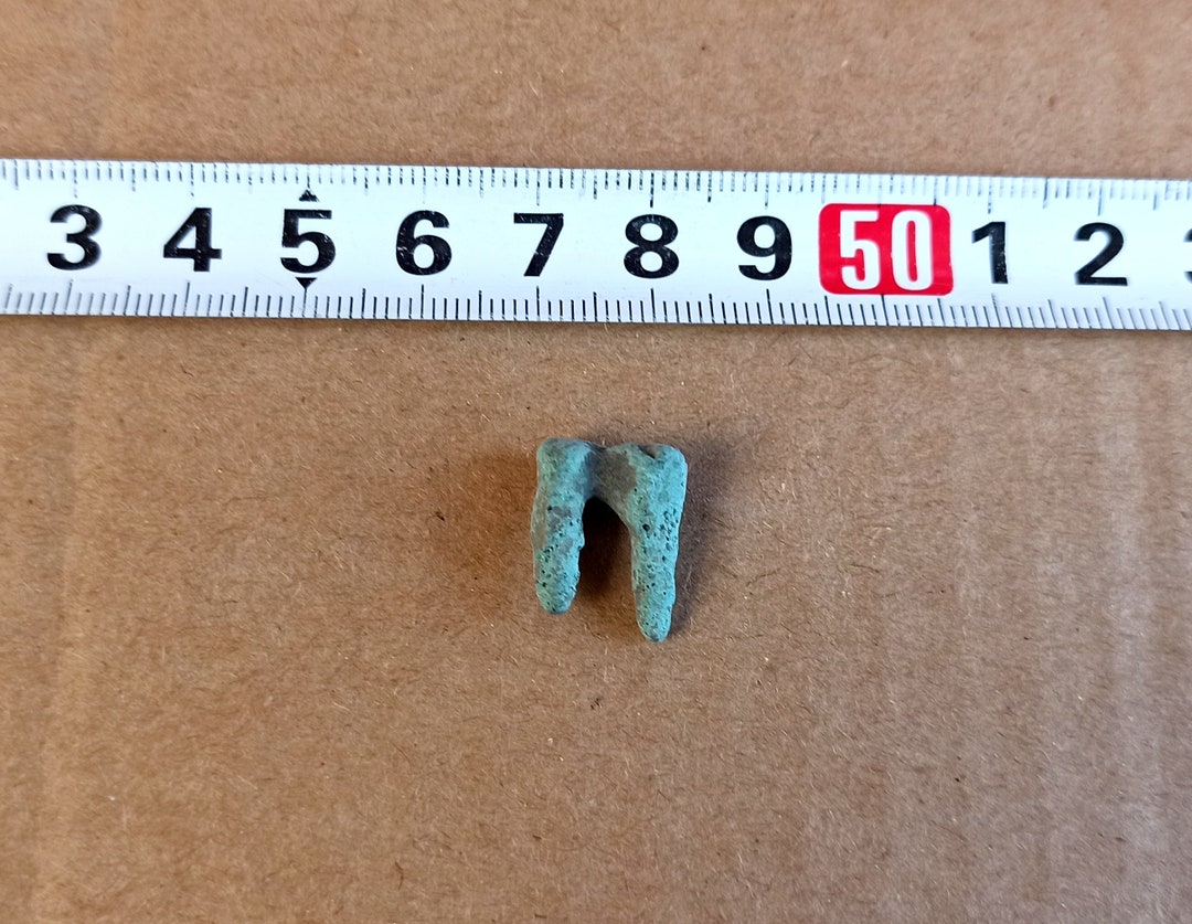 Dental Bronze Filling From the Period BC. Dentistry in Ancient Times ...