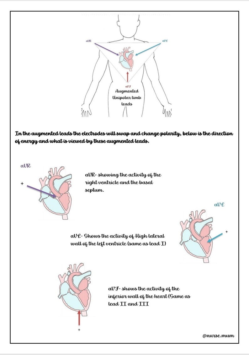 ECG Interpretation Simplified for Nurses - Etsy