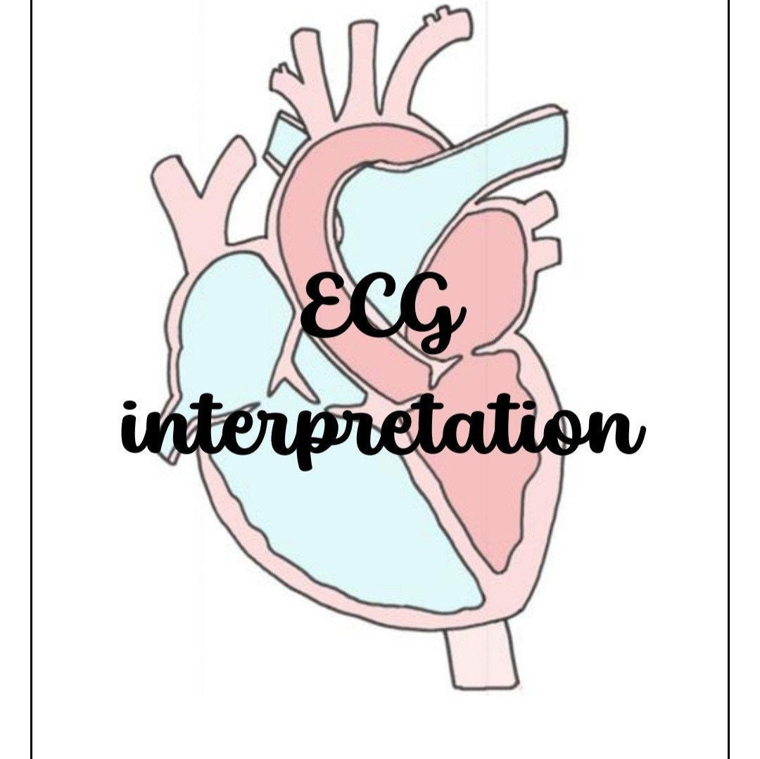 A4 Download: ECG Interpretation - Etsy