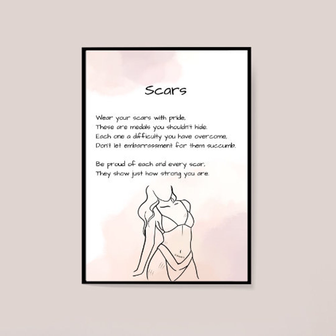 Scars - Body Positive Poem - A4 Mental Health Poem Print - Body Image ...