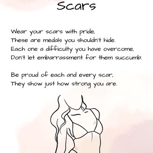 Scars - Body Positive Poem - A4 Mental Health Poem Print - Body Image ...