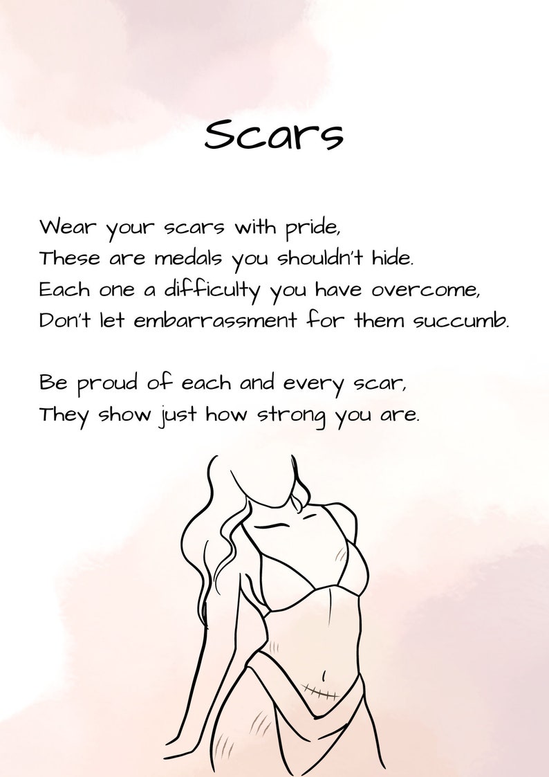Scars - Body Positive Poem - A4 Mental Health Poem Print - Body Image ...