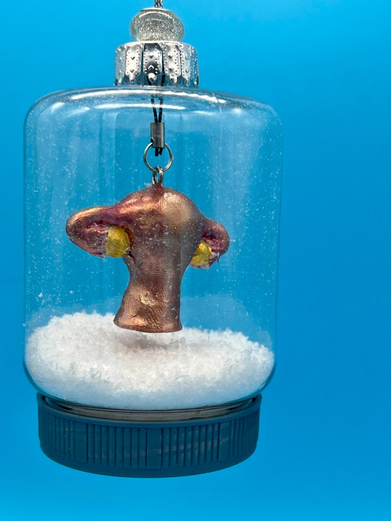 Waterless Uterus & Ovaries Anatomical Organ Snow Globe Masson - Etsy