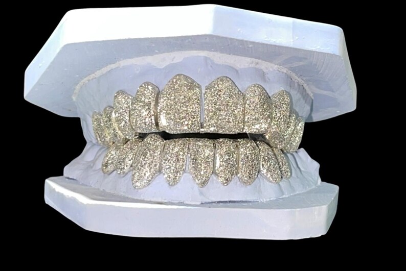 Custom Gold Diamond Dust Grillz | Real Sterling Gold Teeth | Solid ...