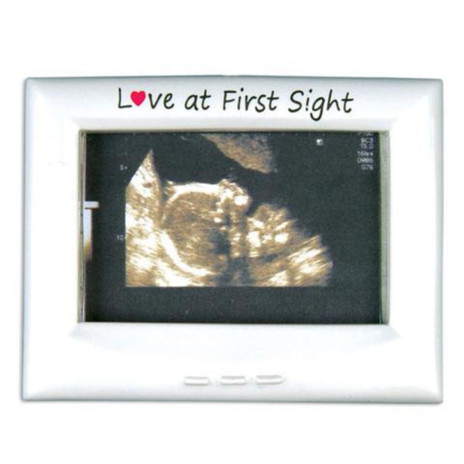 Pregnancy Expecting Baby X Ray Ultrasound Photo Picture Frame ...