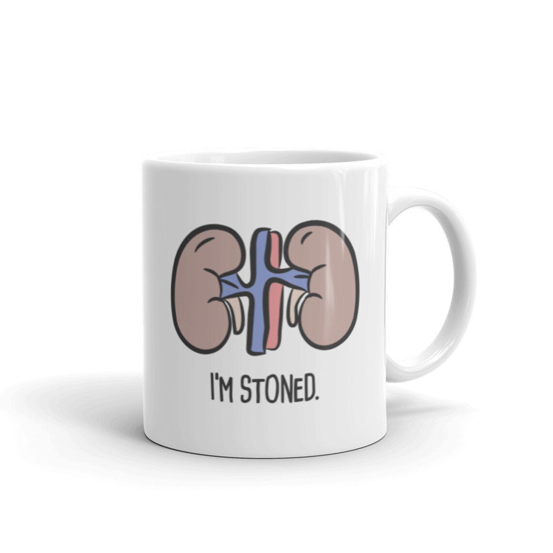 Kidney Stones Surgery Gift / Funny Kidney Stones Mug – "stoned" - Etsy