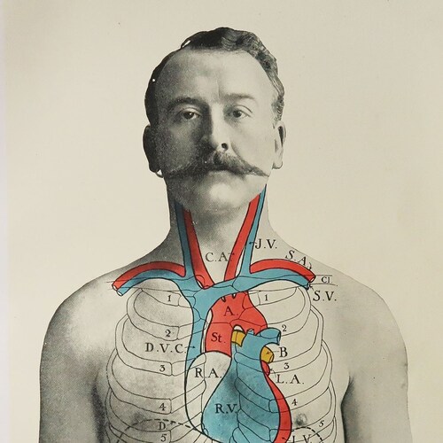 Original Vintage Medical Print or Poster - Etsy