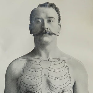 Original Vintage Medical Print or Poster - Etsy