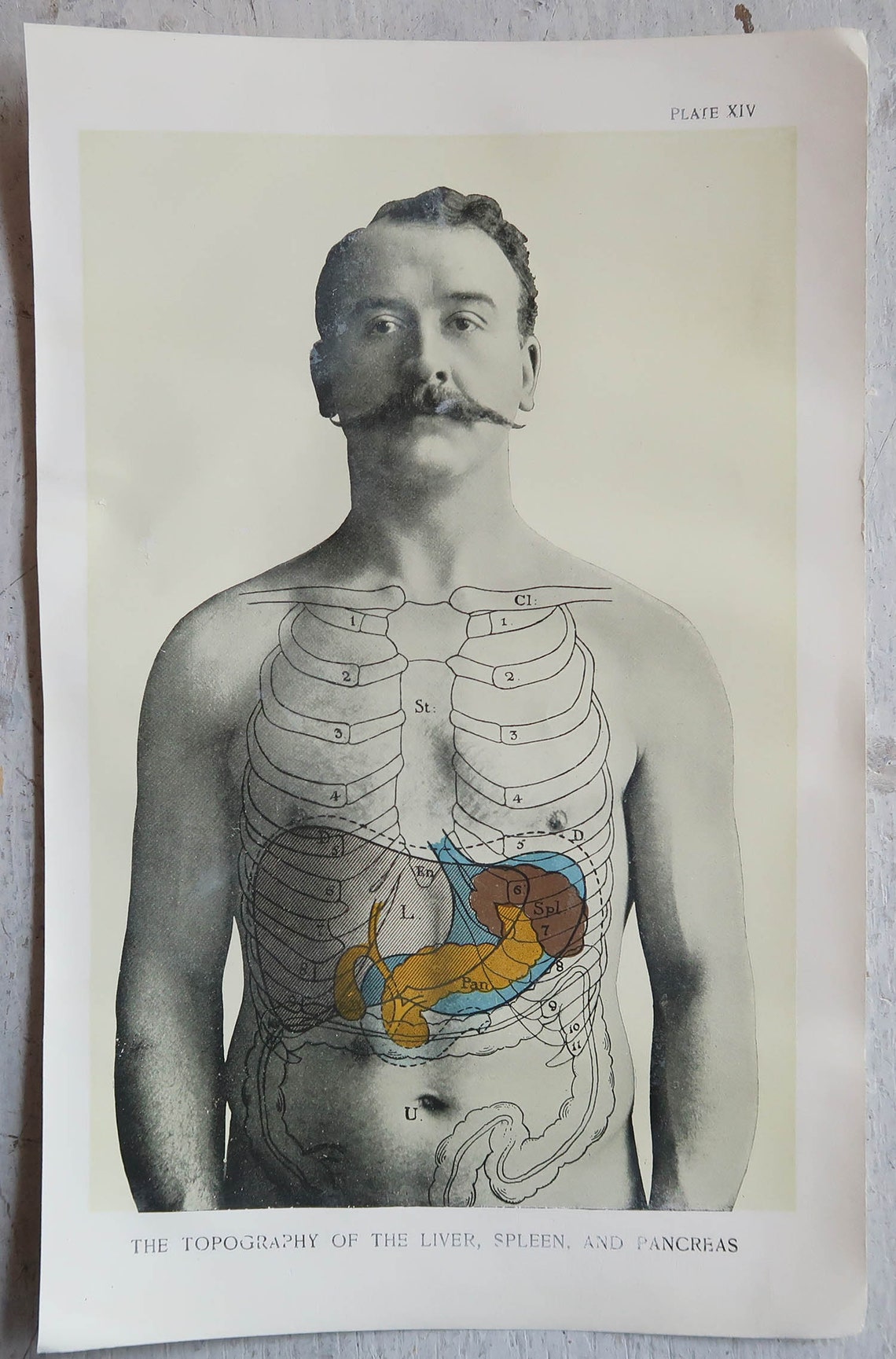 Original Vintage Medical Print or Poster - Etsy