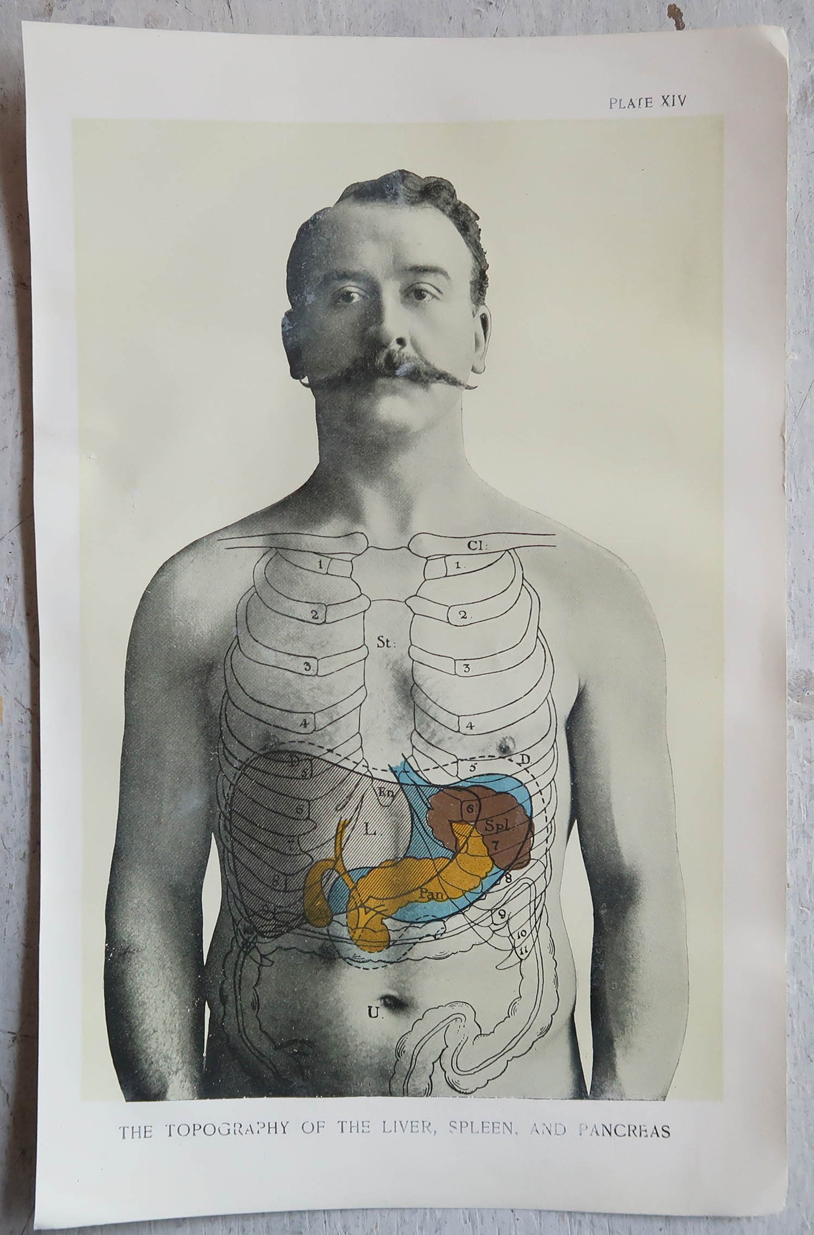 Original Vintage Medical Print or Poster - Etsy