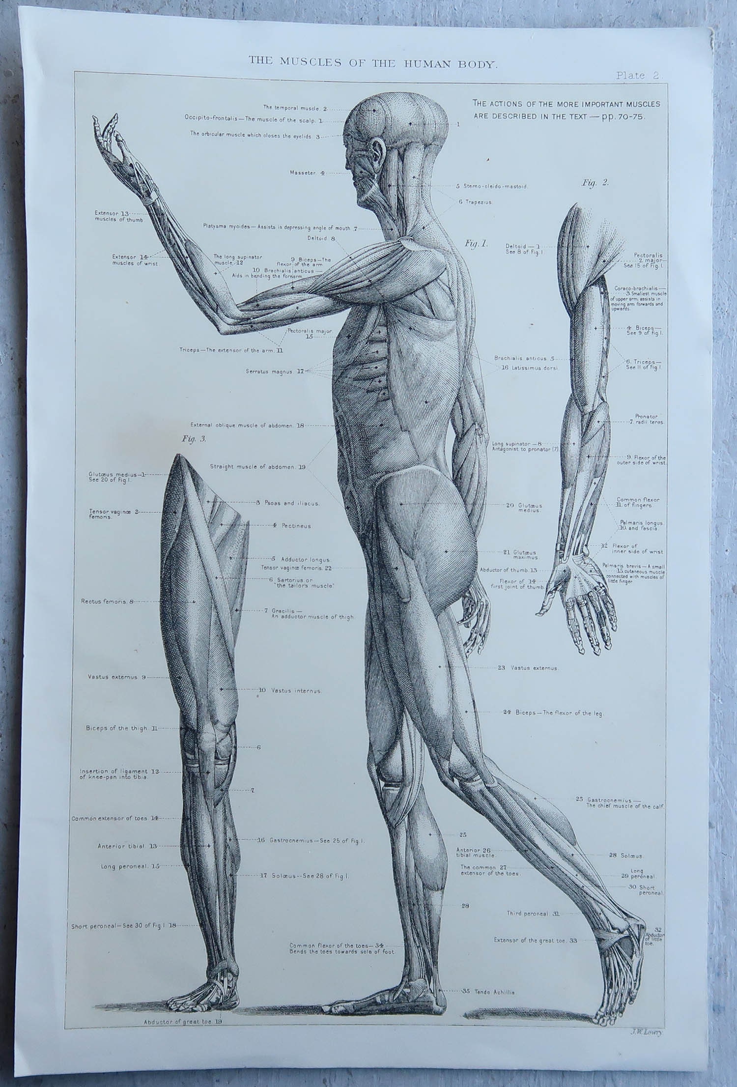Original Vintage Medical Print. Muscles of the Human Body - Etsy