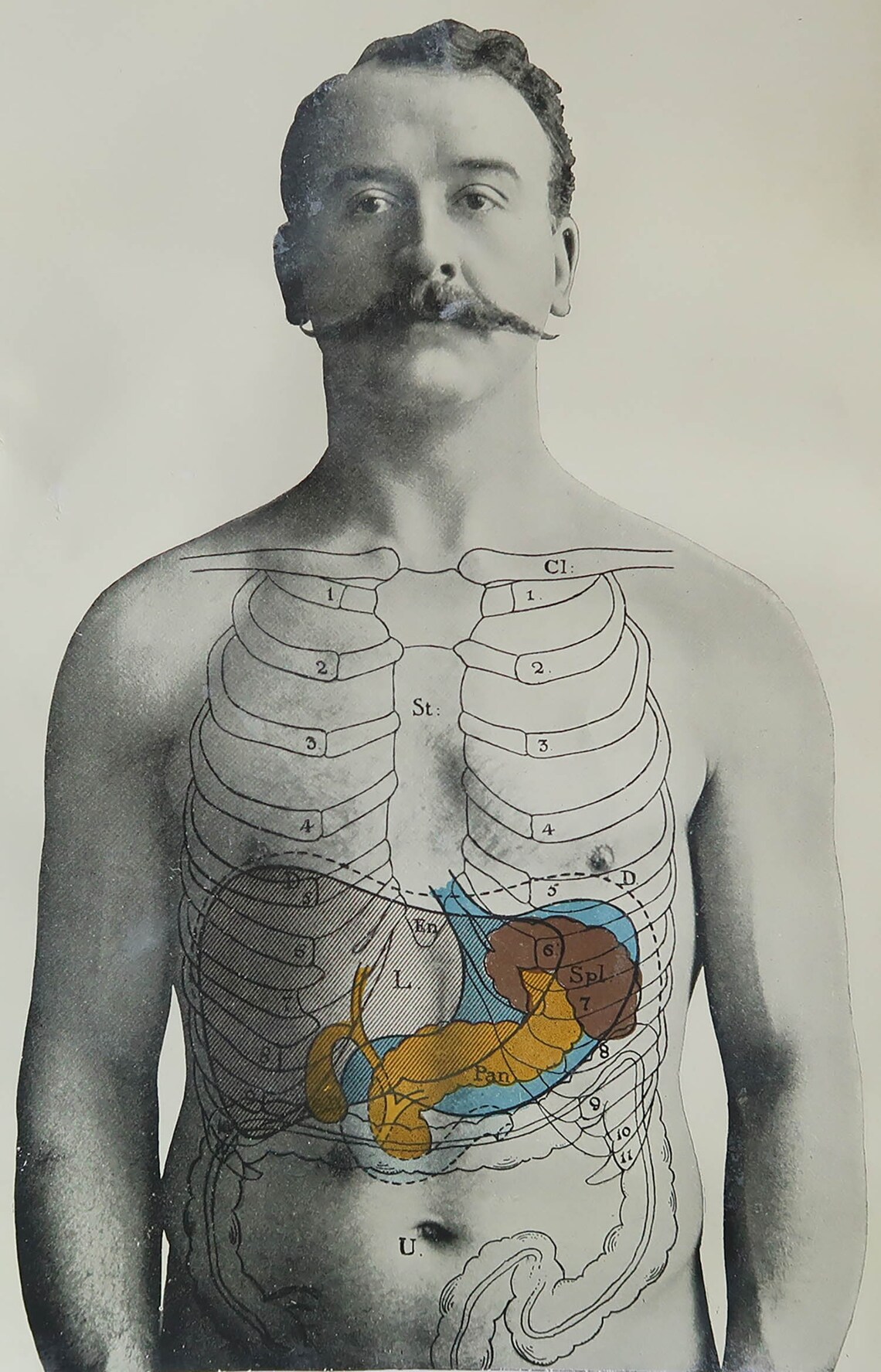 Original Vintage Medical Print or Poster - Etsy