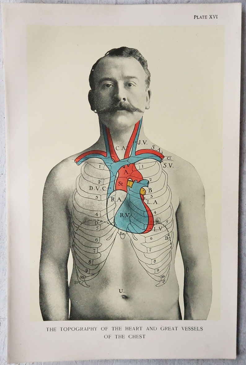 Original Vintage Medical Print or Poster - Etsy