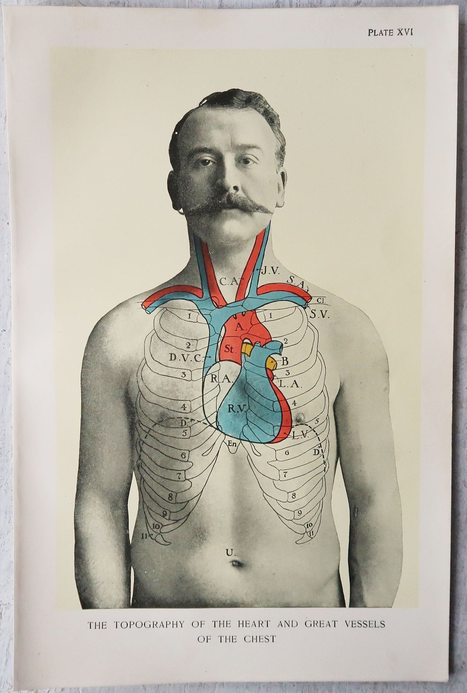 Original Vintage Medical Print or Poster - Etsy