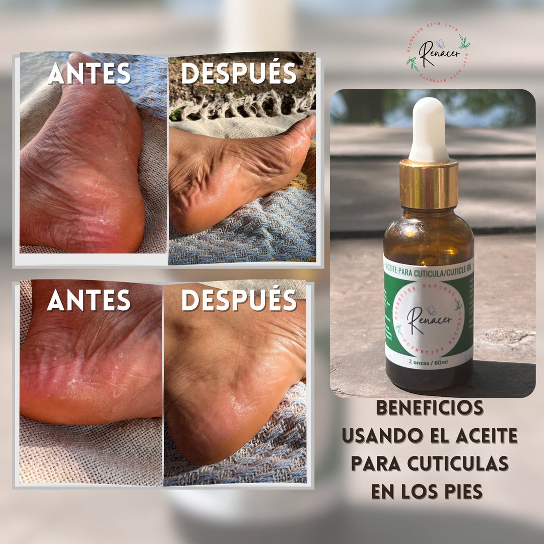 Aceite para Cutícula, Aceite hidratante para Manos y Pies, Aceite ...