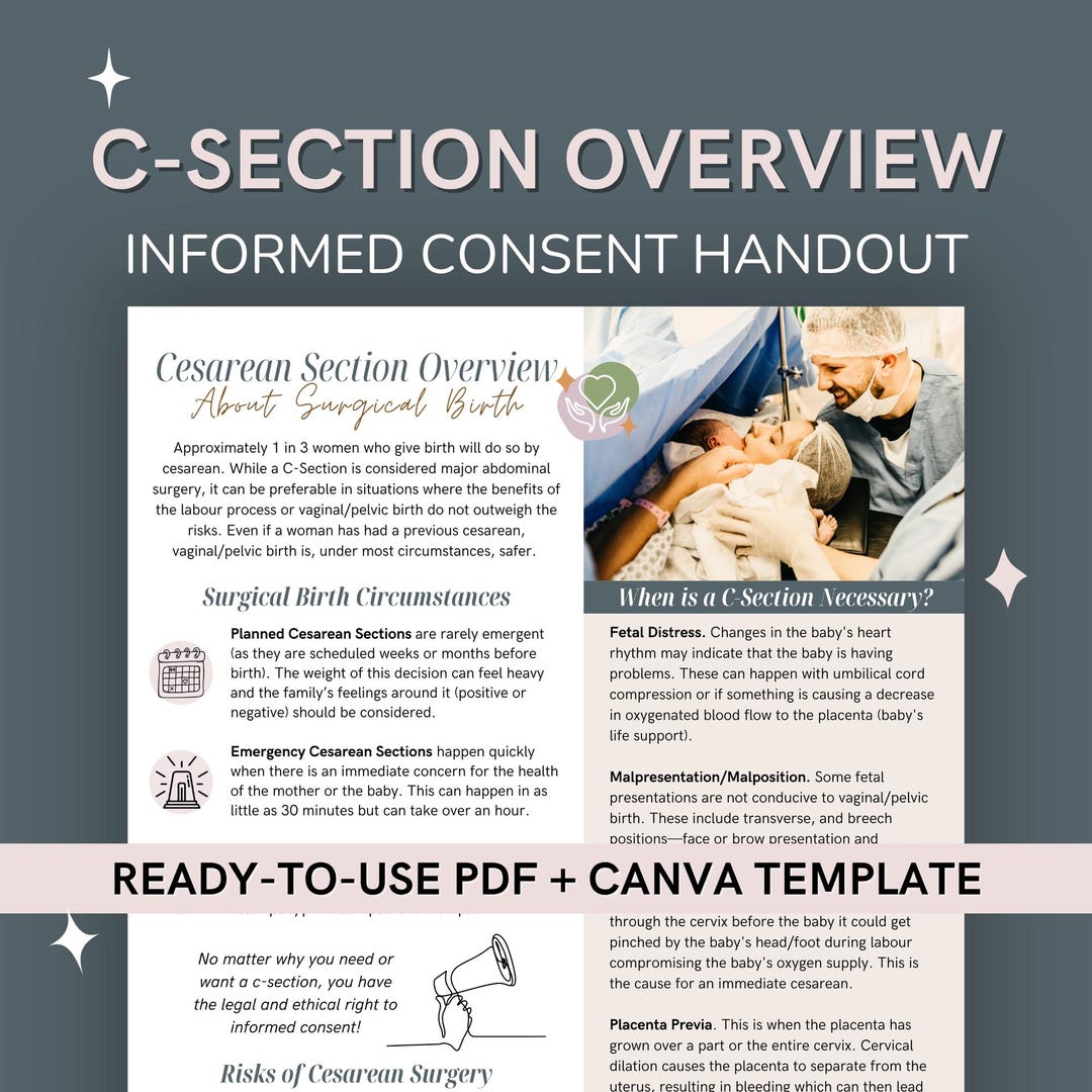 Cesarean Birth Education Guide: Editable Canva Template & Printable PDF ...