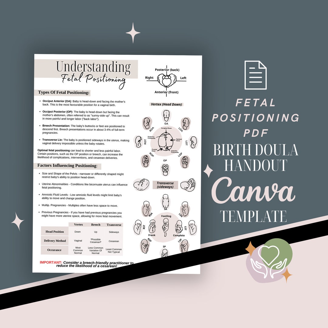 Birth Doula Understanding Fetal Positioning Chart Childbirth Education ...