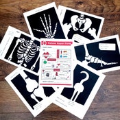 Printable X-rays for Kids. Pretend Play Kids X-ray Activity for Playing ...