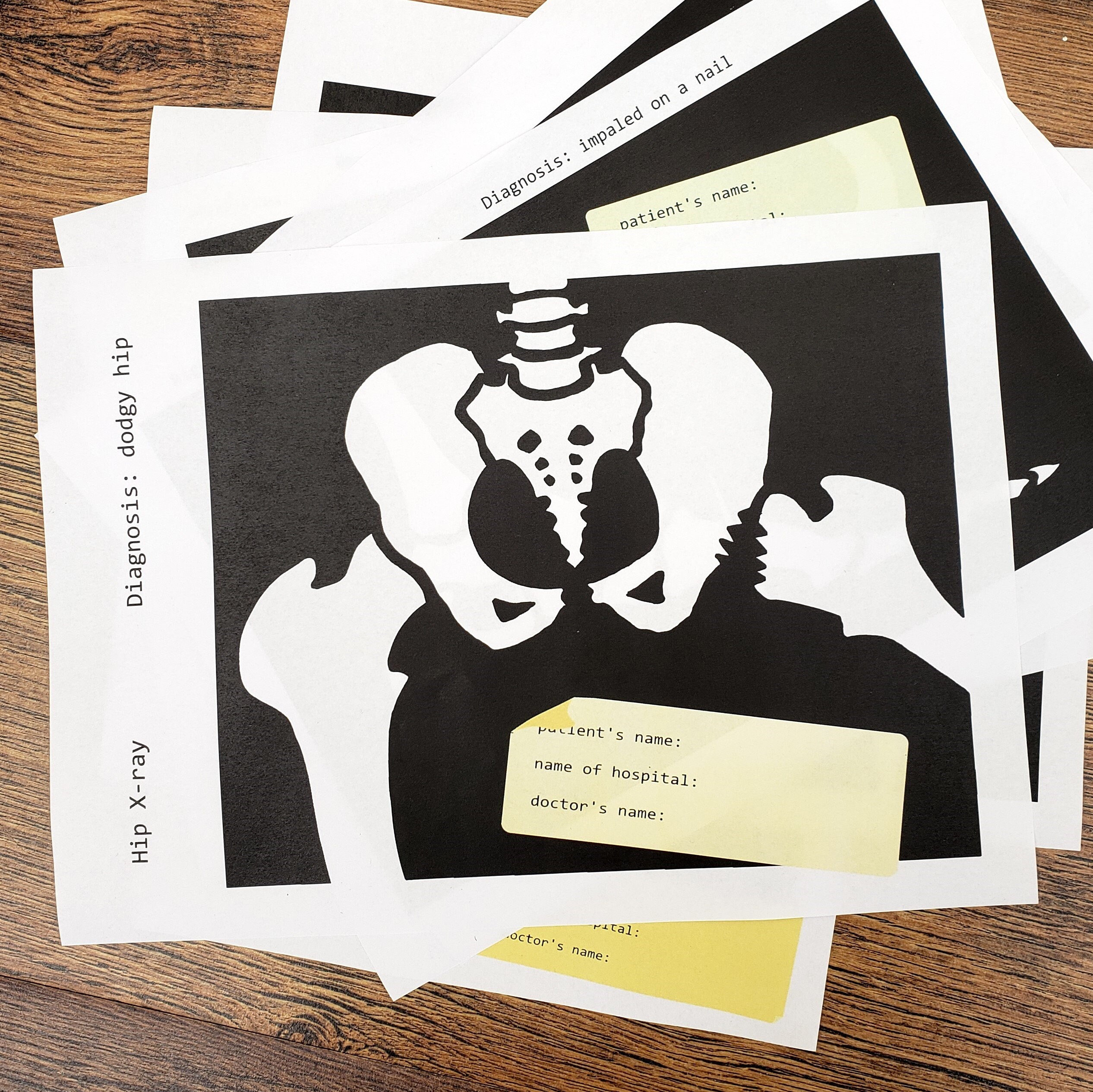 X-ray of a Dodgy Hip for Kids Playing Doctors and Nurses. Ideal to Go ...