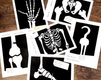 Printable X-rays for Kids. Pretend Play Kids X-ray Activity for Playing Doctors and Nurses ...