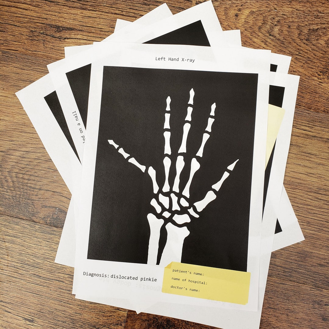 X-ray of the Hand for Kids - Ideal for Playing Doctors and Nurses With ...
