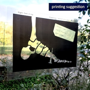 Foot X-ray for Kids - Doctor and Nurse Game (PDF Download) - Etsy