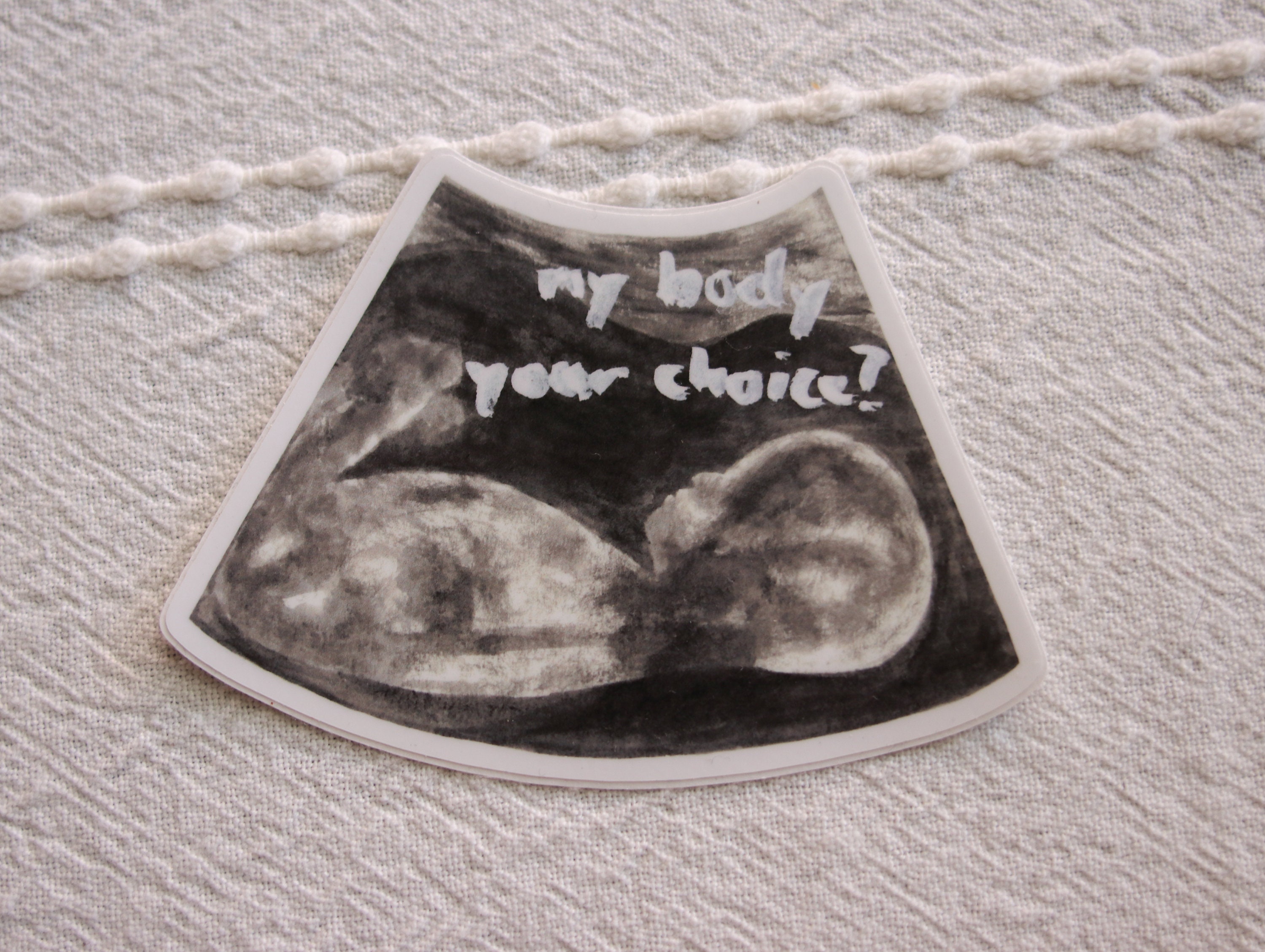 Pro-life Ultrasound "my Body Your Choice?" Waterproof Sticker for Water ...