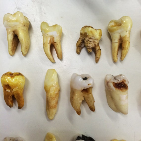 Real Tooth