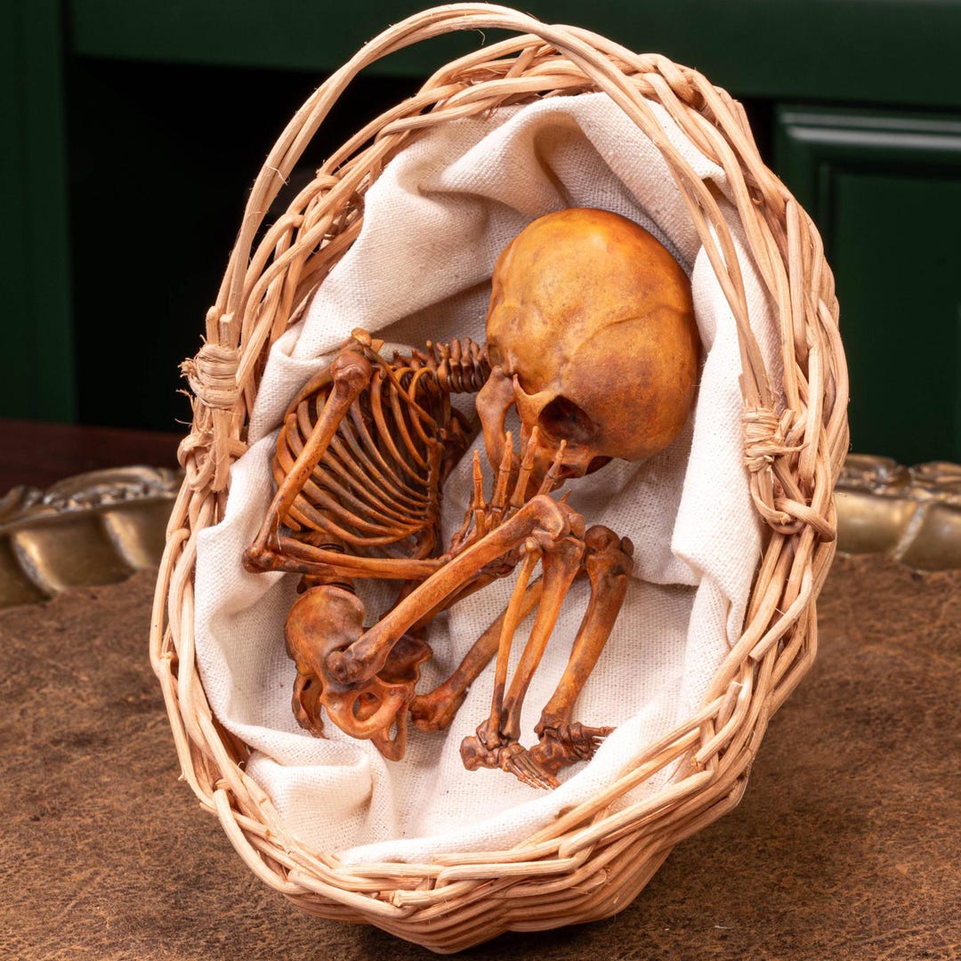 3D Printed Human Fetus Infant Skeleton in Rattan Basket, Hand Painted ...