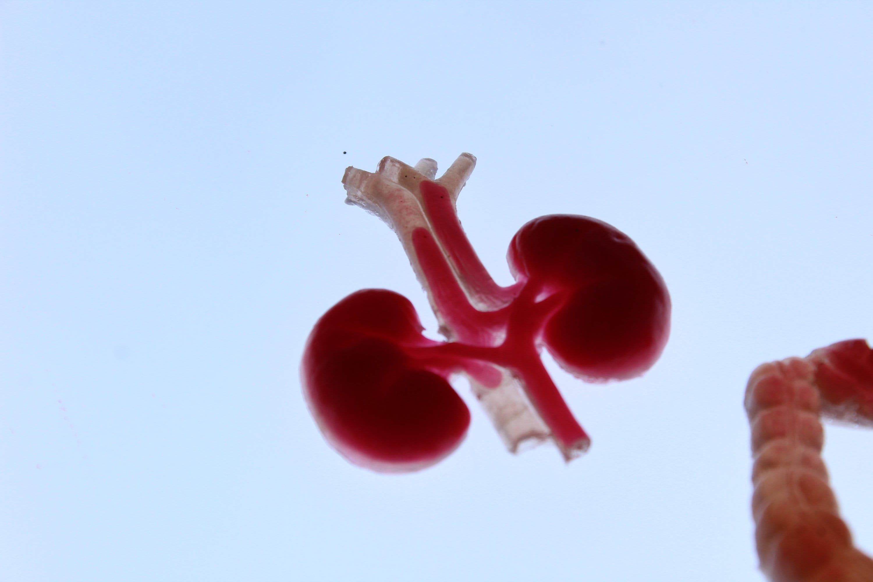 Anatomically Correct Solid Resin Miniature Organs. - Etsy