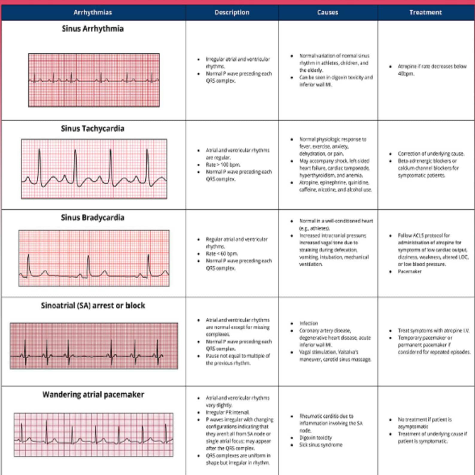 Basic EKG Interpretation 3 Pages Long Printable Pdf - Etsy Basic EKG Interpretation 3 Pages Long Printable Pdf - Etsy