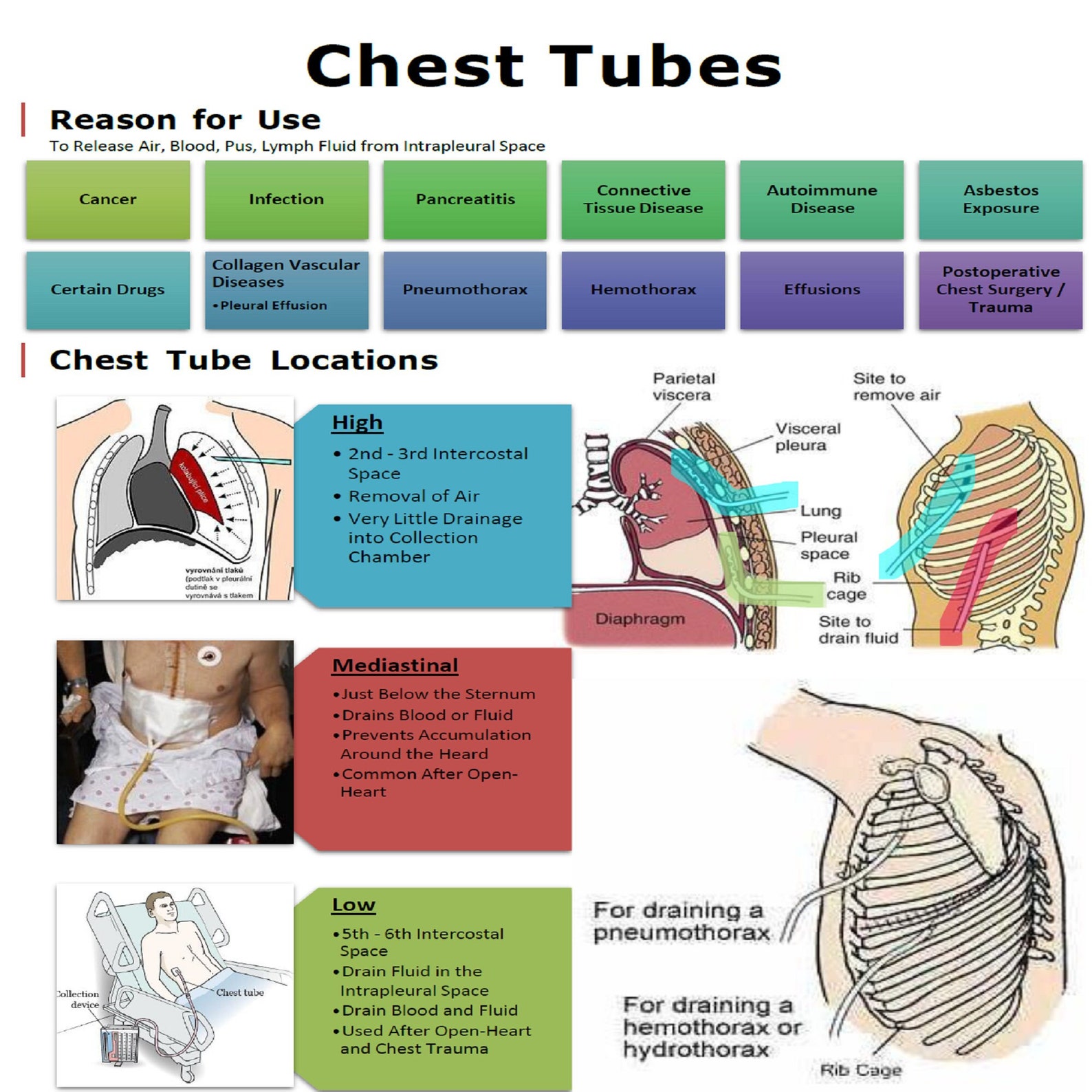 Critical Care CHEST TUBES Everything You Need to Know 15 Pages - Etsy