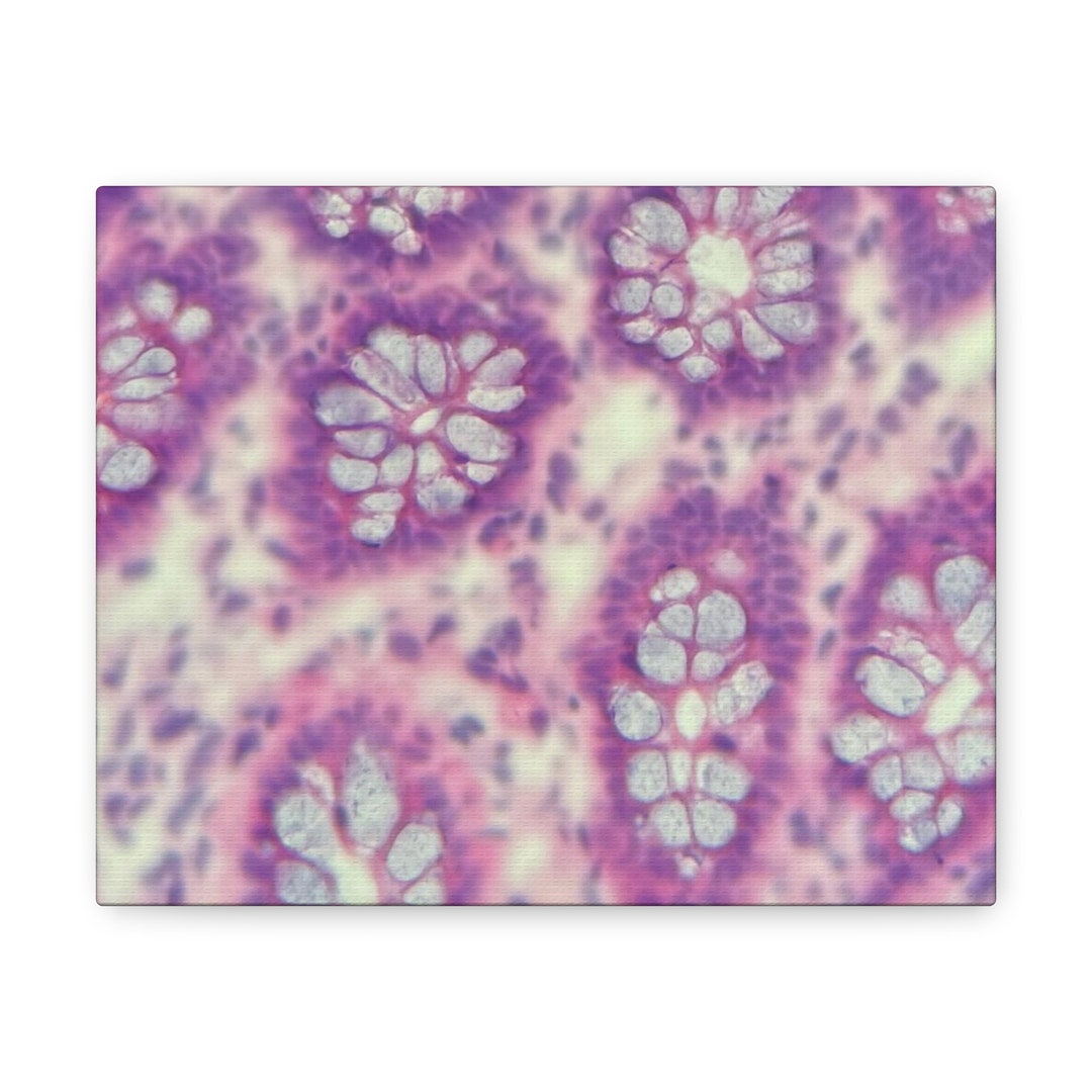 Colon Mucosa Large Intestine Bowel Histology Pathology Microscope ...