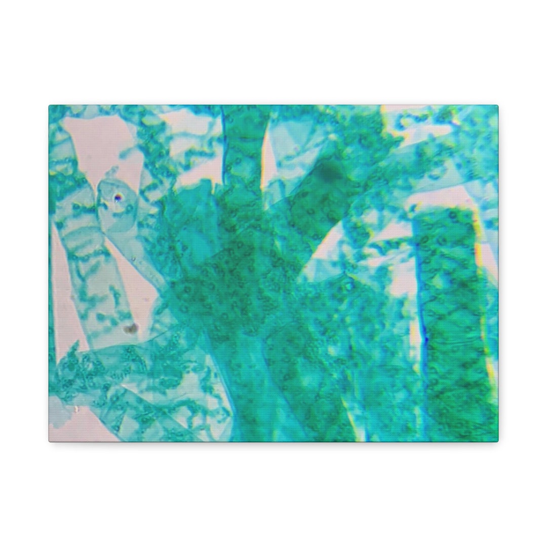 Spirogyra Algae Microscope Image Histology Microscopy Microbiology ...