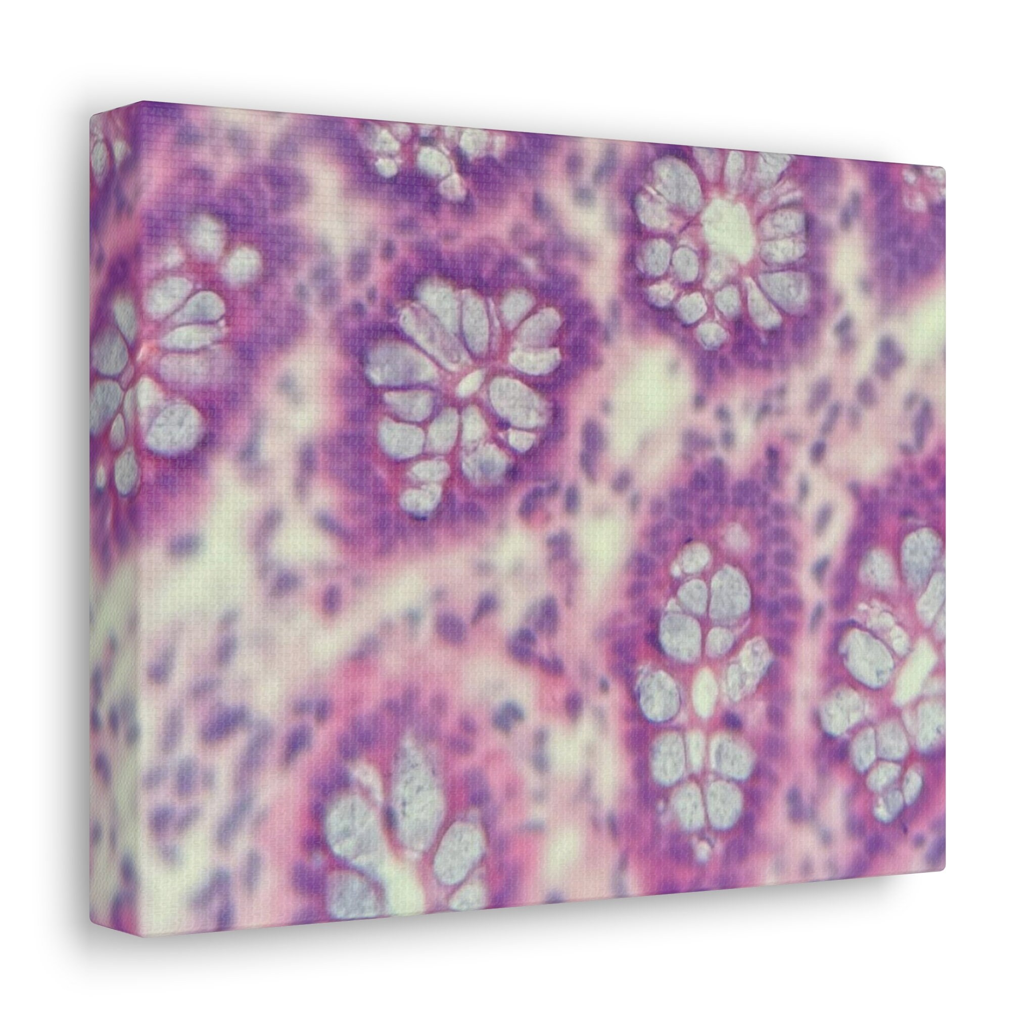 Colon Mucosa Large Intestine Bowel Histology Pathology Microscope ...