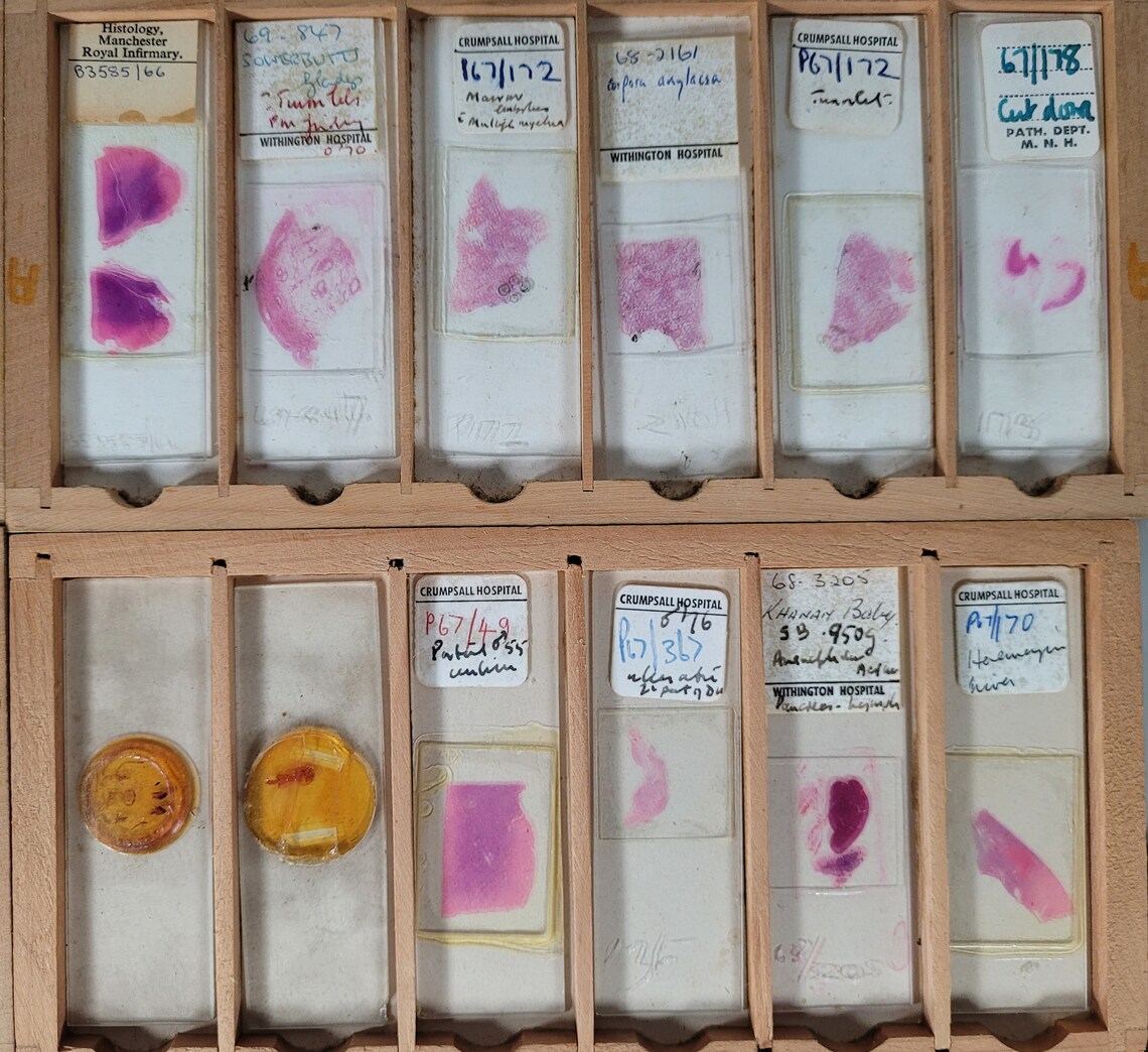 72 Antique and Vintage Microscope Slides: 72 Slides in Wooden Box - Etsy