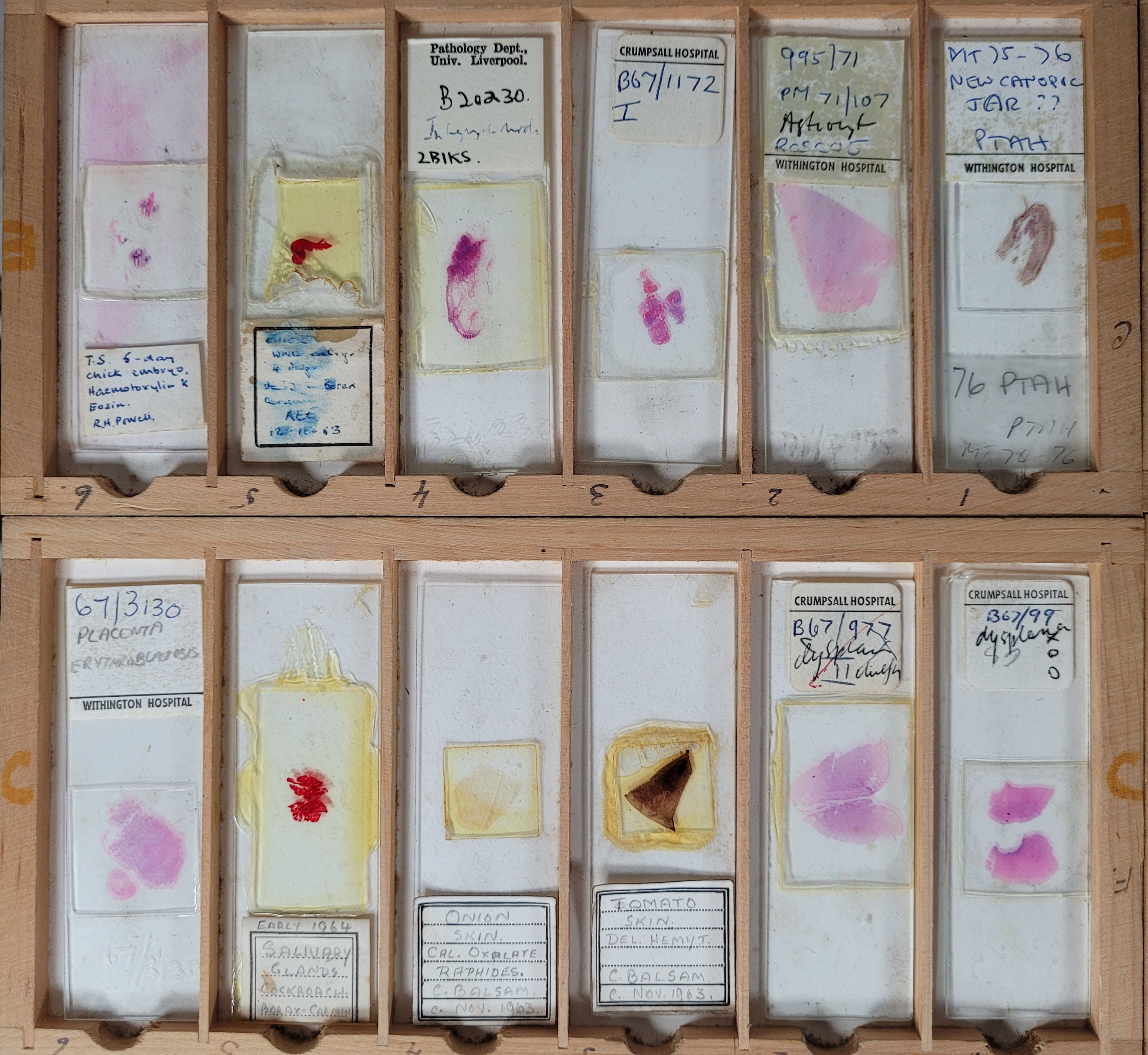 72 Antique and Vintage Microscope Slides: 72 Slides in Wooden Box - Etsy