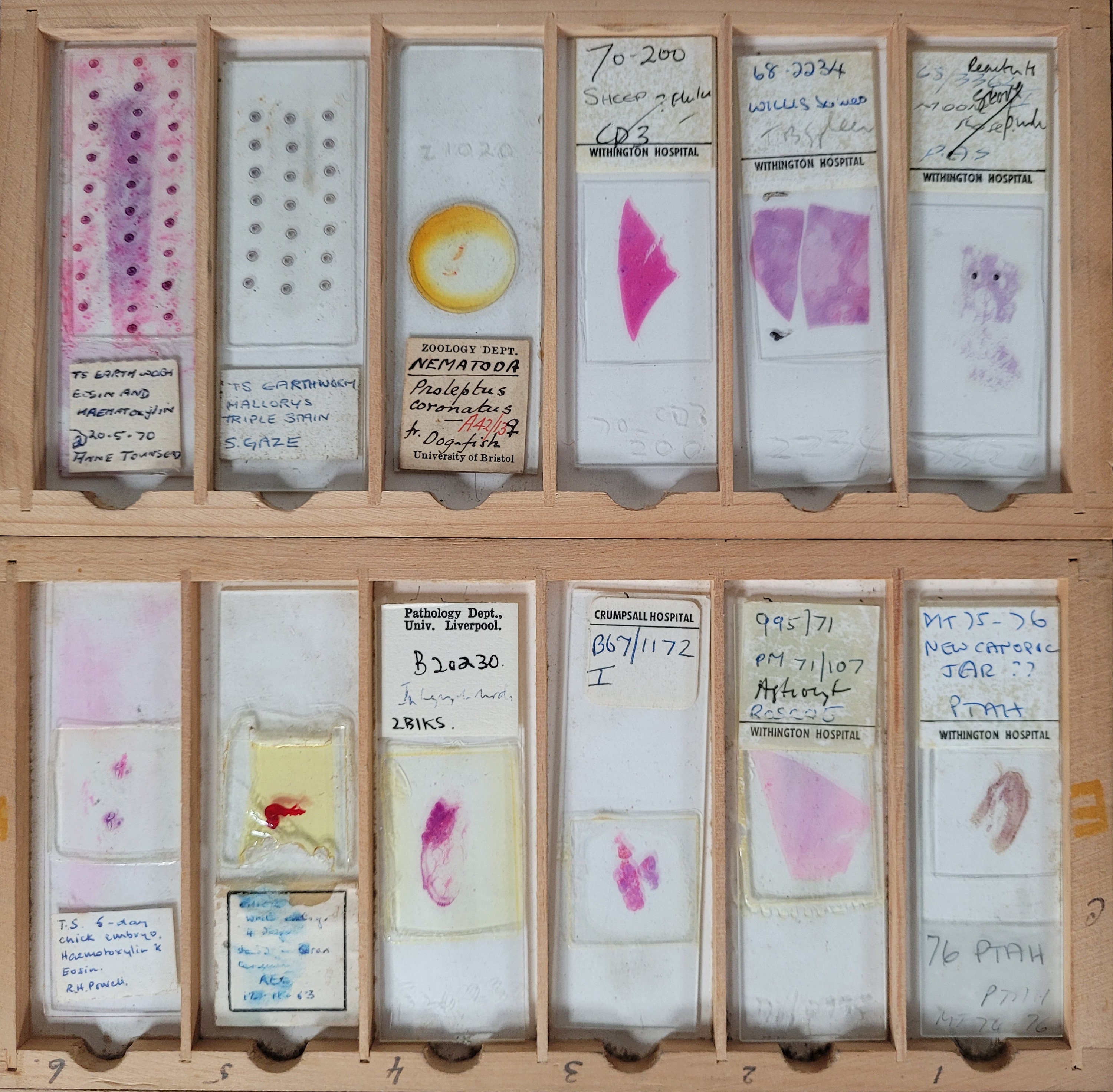 72 Antique and Vintage Microscope Slides: 72 Slides in Wooden Box - Etsy