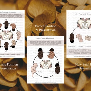 Fetal Position 3 Pack INSTANT DOWNLOAD Professional Handouts Pregnancy ...